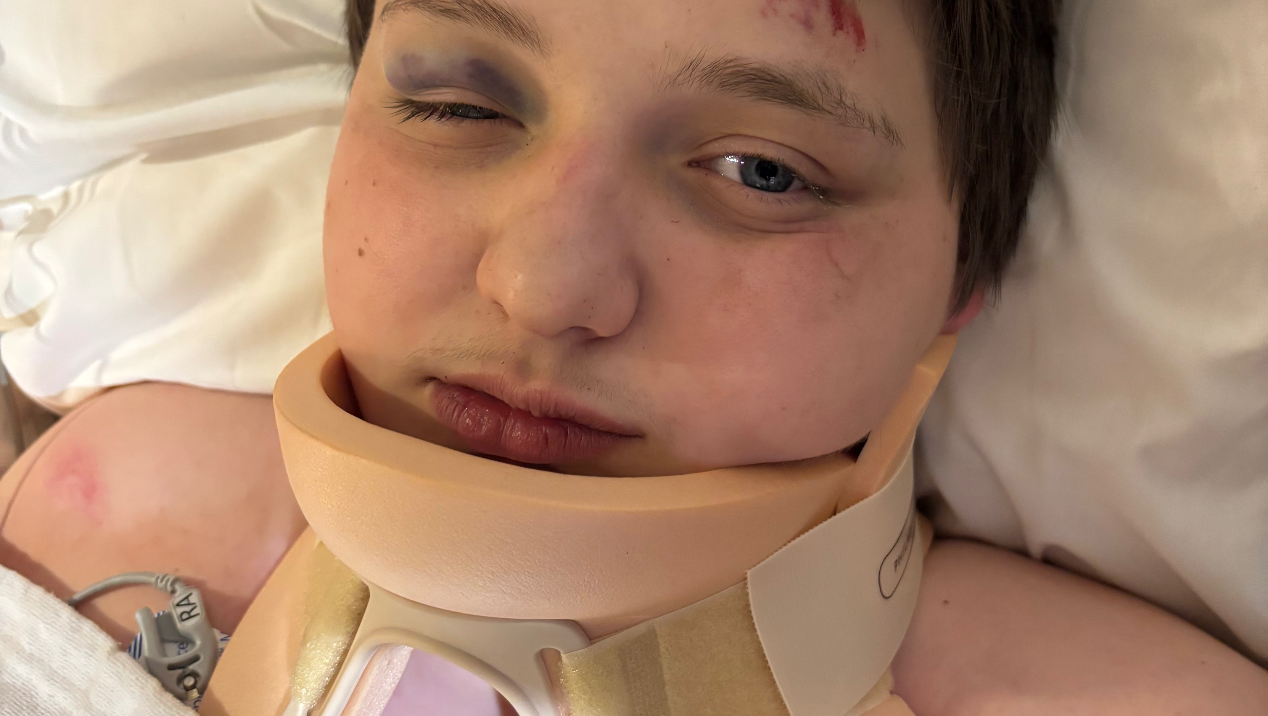 Fundraiser by Myrtle Farrell : Help Dustin Heal: Brain Injury and Skull ...