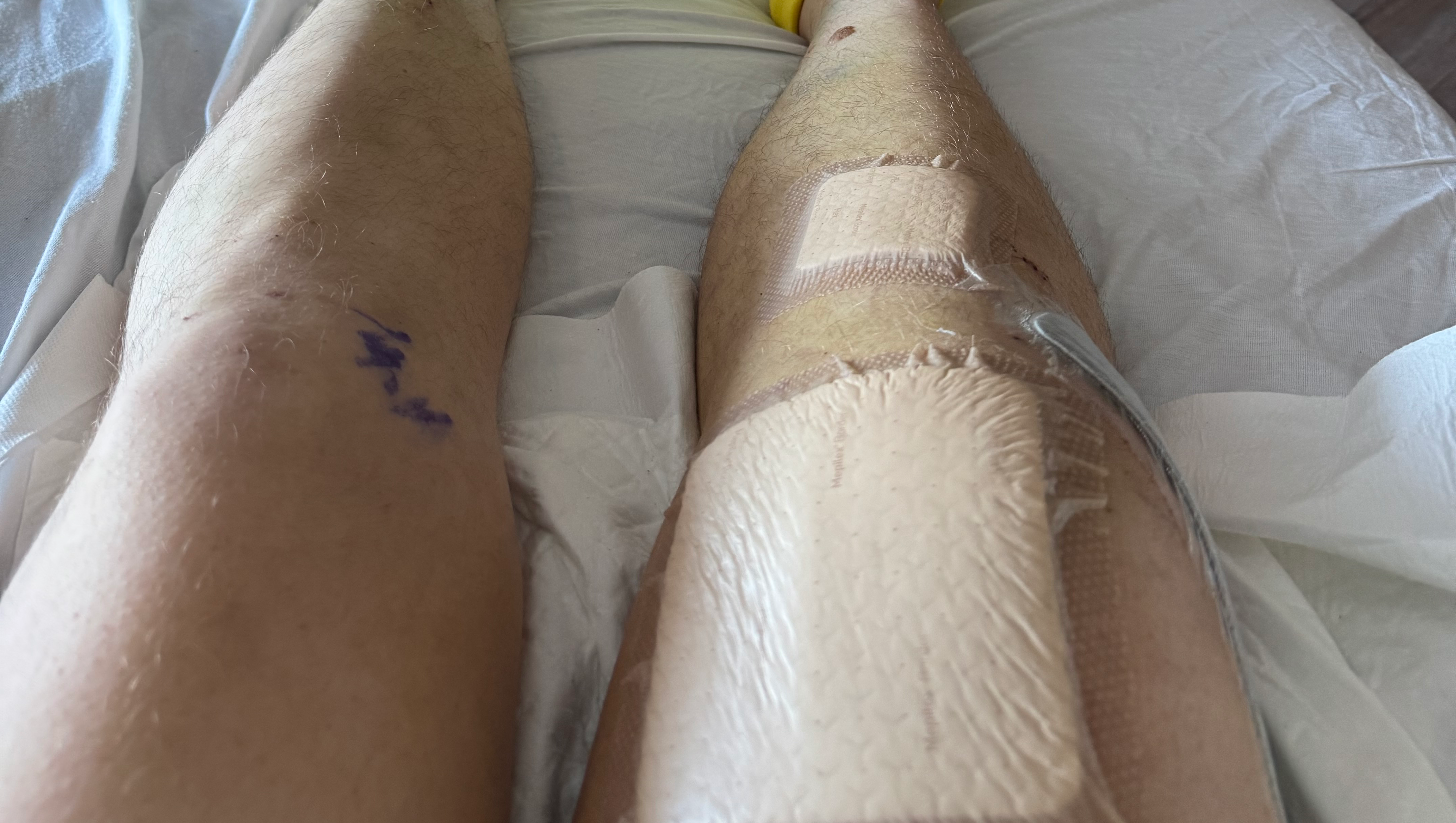 Fundraiser by Amy Gebert : Help My Husband Heal After a Devastating Crash