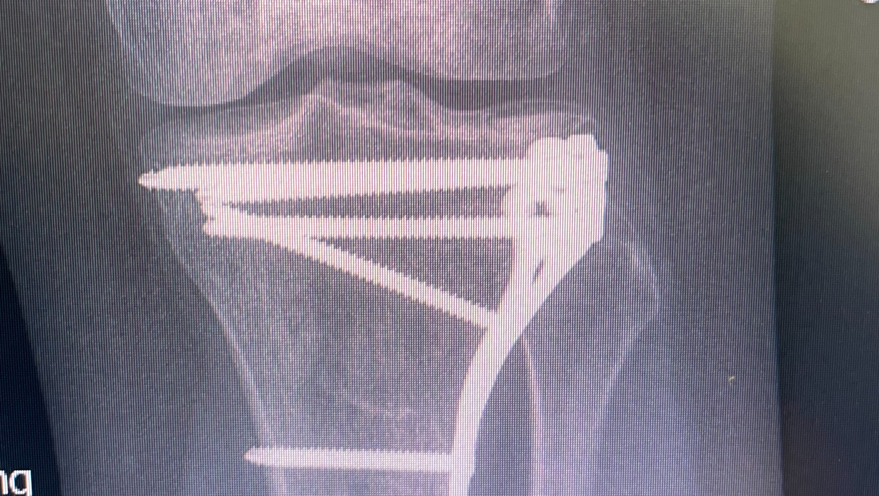 Fundraiser by Sarah Saint-Cyr : Help remove the 8 screws and plate from ...