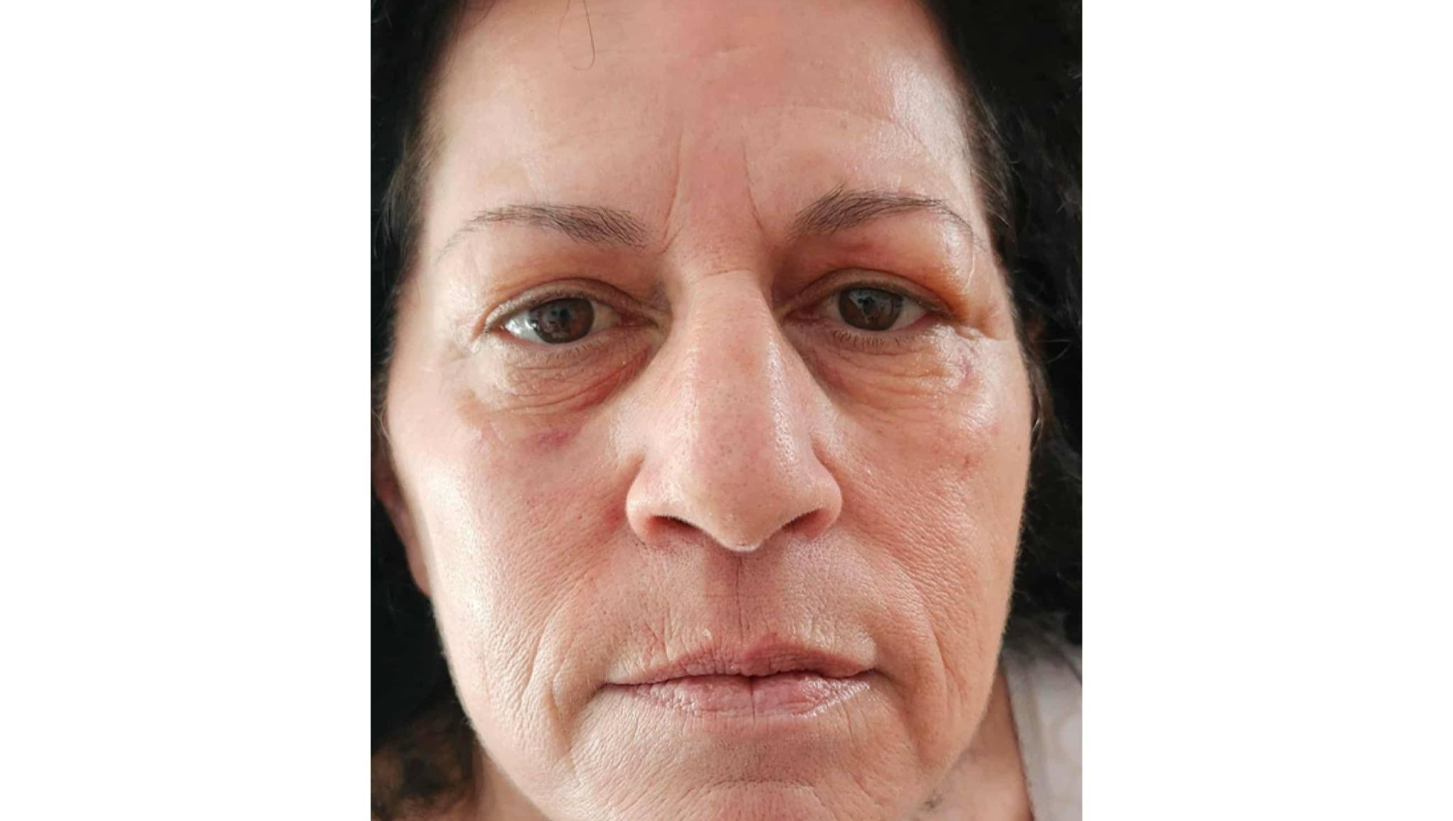 Fundraiser for Suzie Maurice by Cody Bernard : Helping our mother Suzie ...