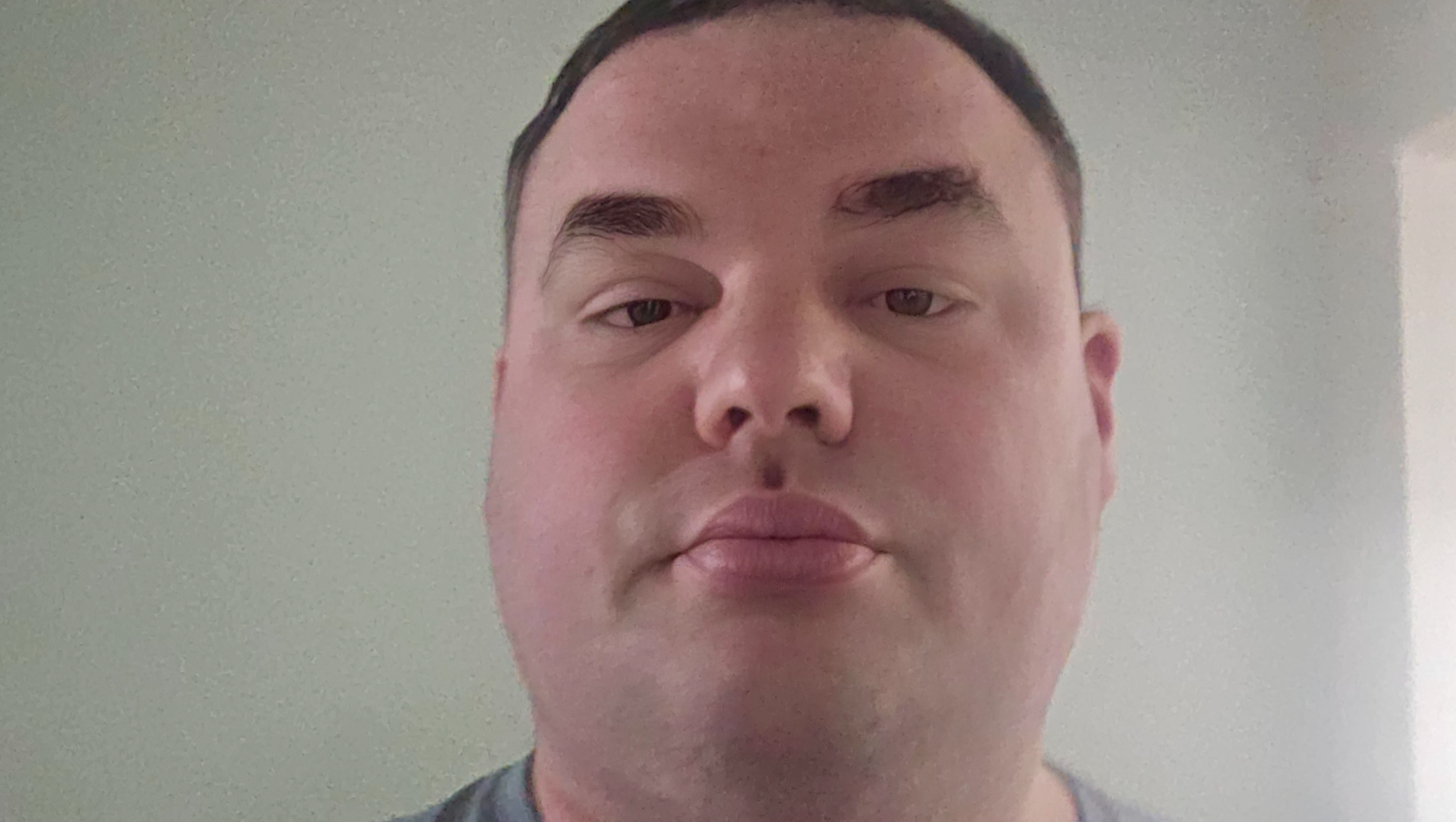 Fundraiser by John Stem : Donate to help John's Surgery and Recovery