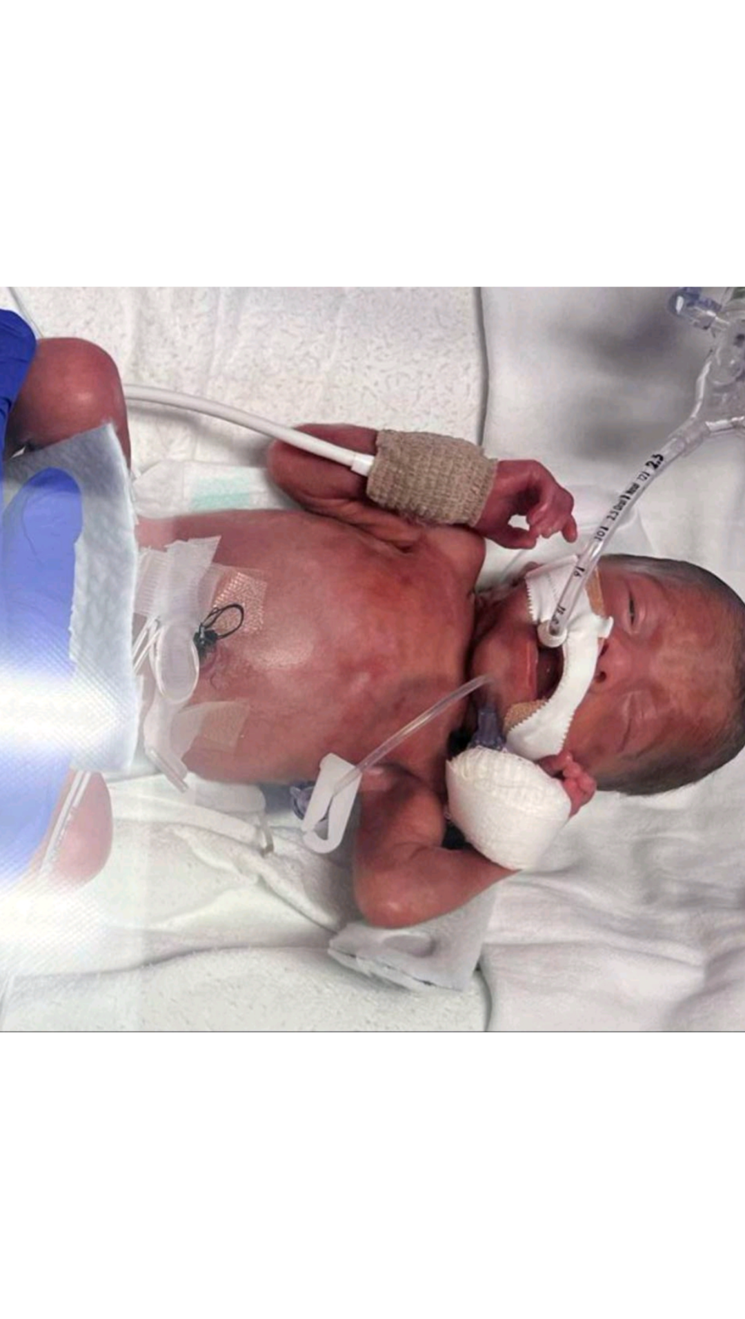 Fundraiser by Melissa Potvin : Aidez la petite Hailey