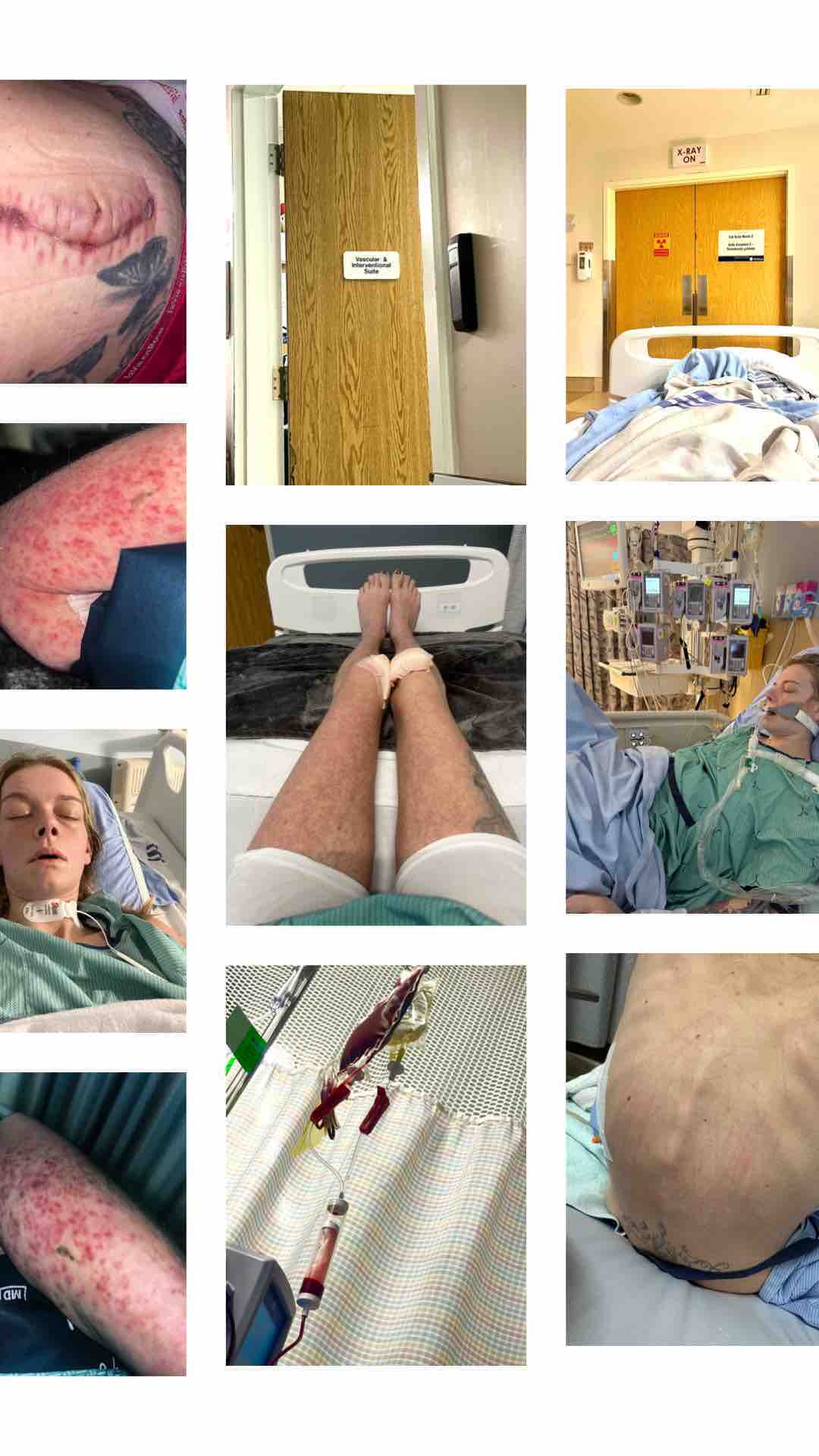 Fundraiser for Hannah Taylor Buck by Family Of Hannah Buck : Please ...