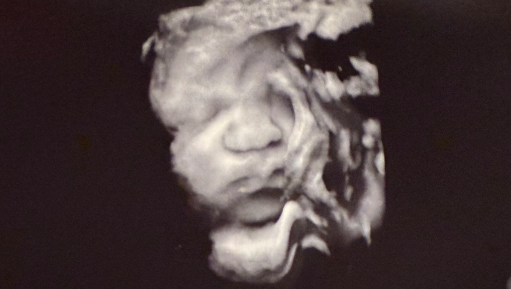 Fundraiser for Amanda Butler by Gracyn Butler : Rally for Arthur's ...