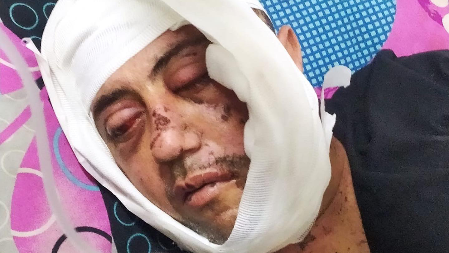 Fundraiser by Laura Jain : Youssef Badly Injured, Lost Wife & Children ...