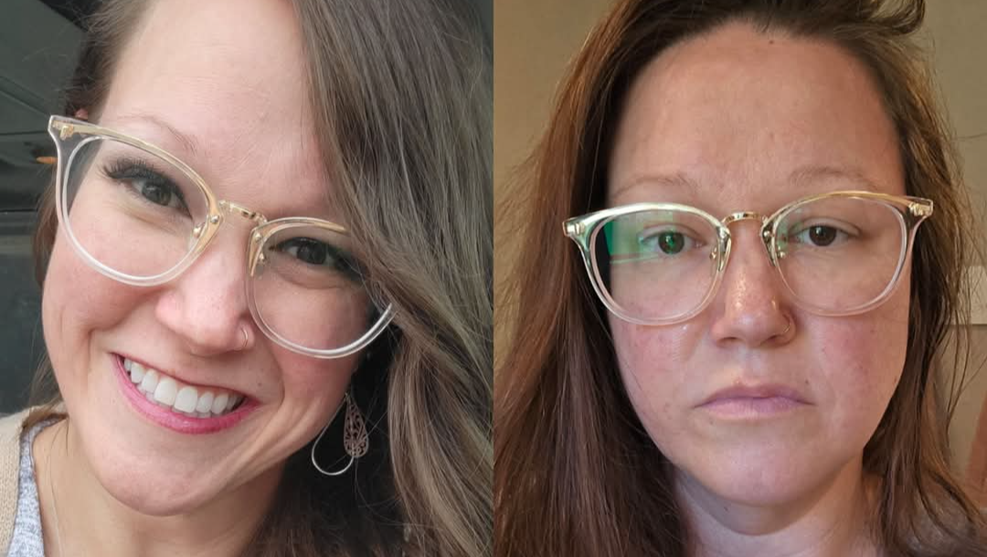 Fundraiser by Bethany Medler : Bring Back Devin's Smile and Energy