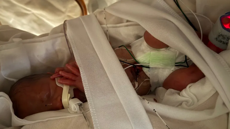 Fundraiser for Alexis McDowell by Jasmyne Snipes : Help Support Lexie ...