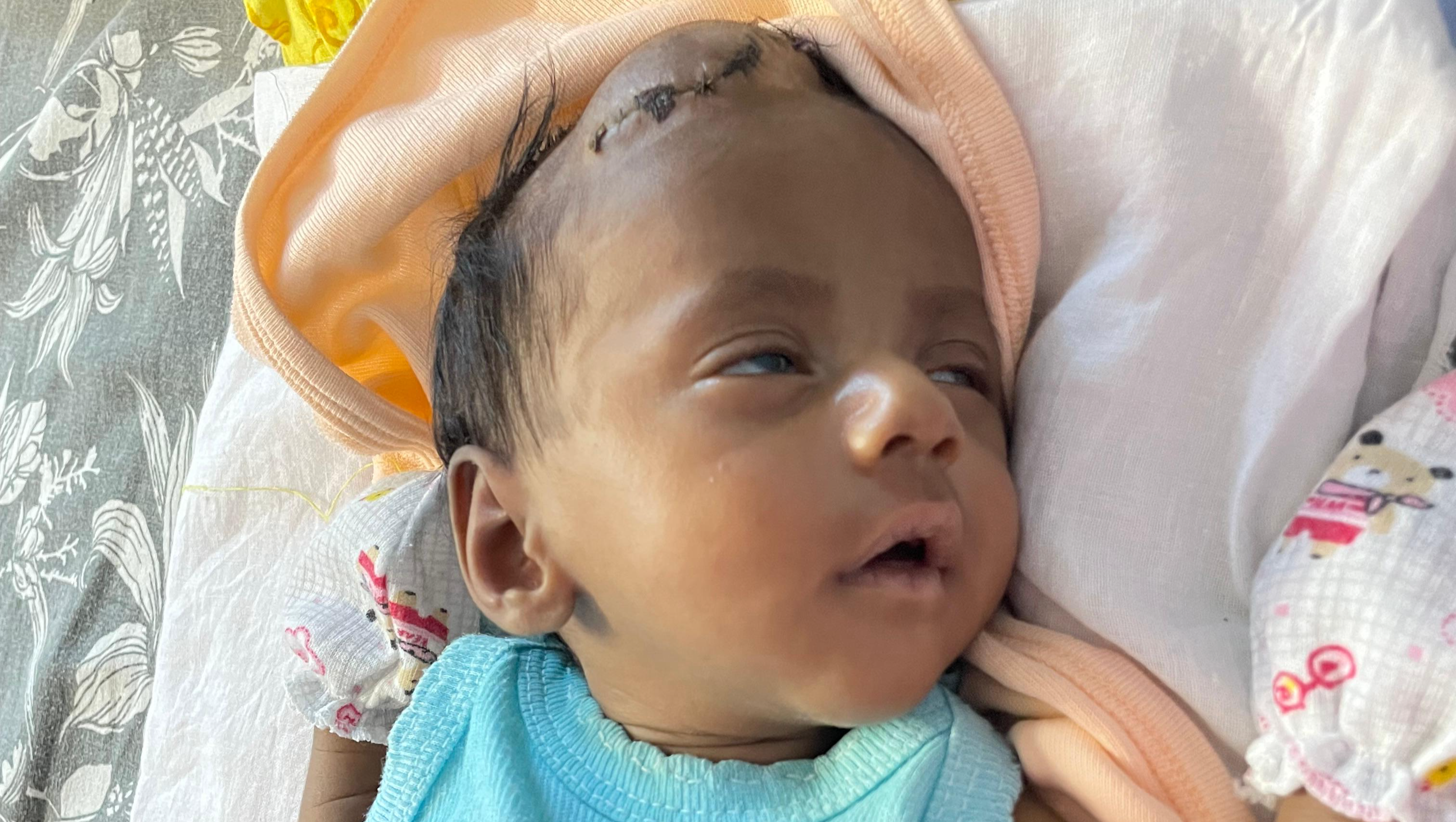 Fundraiser by Yamini Chebrolu : Help the Newborn Heal – Urgent Brain ...