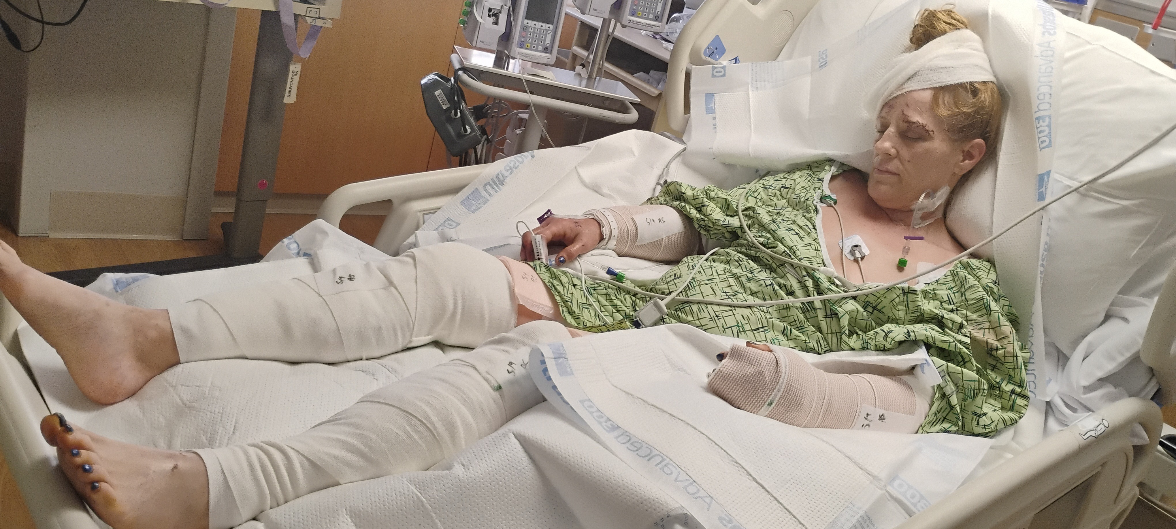 Fundraiser by Jackie Slade Ward : Support for Jennifer Slade's Recovery ...