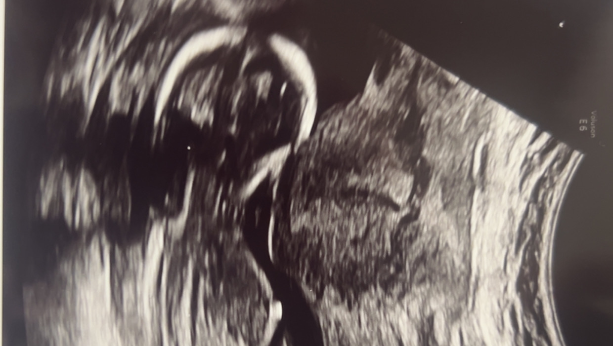 Fundraiser by caitlyn bussey : Help Us Cremate Our Angel Baby Boy