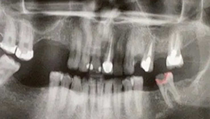 Fundraiser by Jessica Rains : Help support Jes's Journey to Health and ...