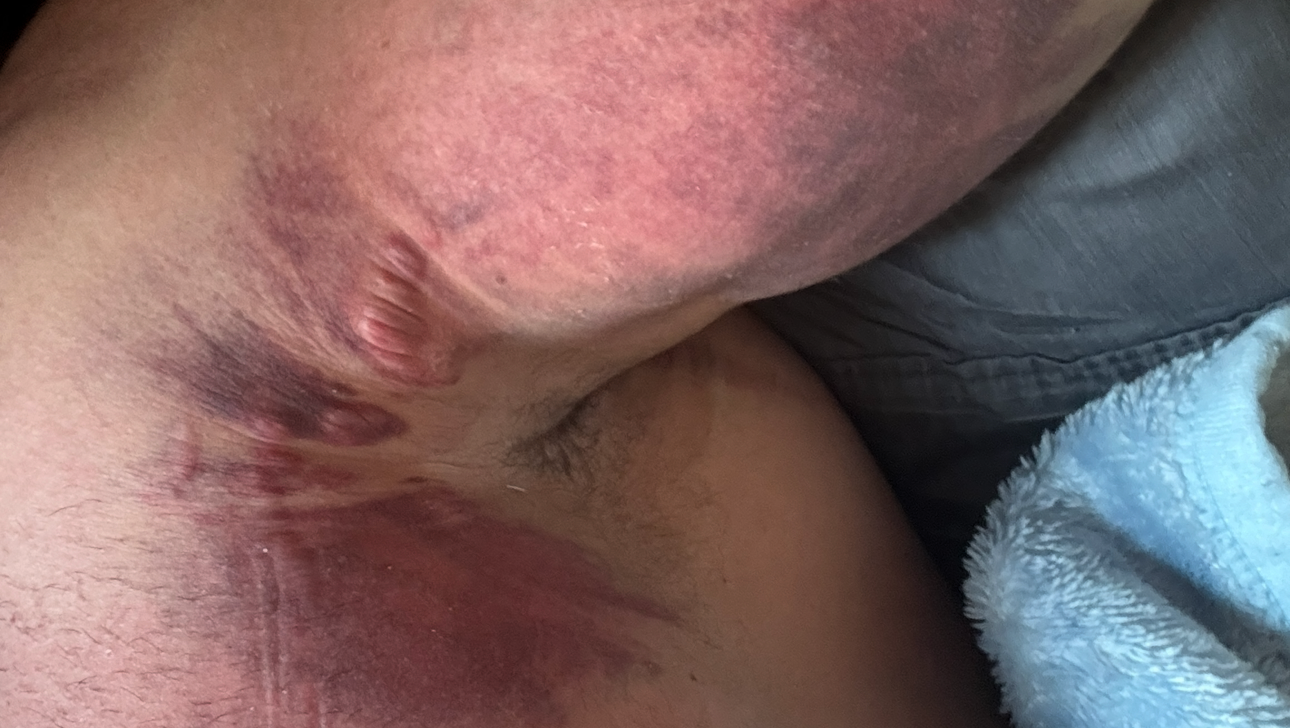 Fundraiser by Justin Garrick Jensen : My expenses as I am not able to ...