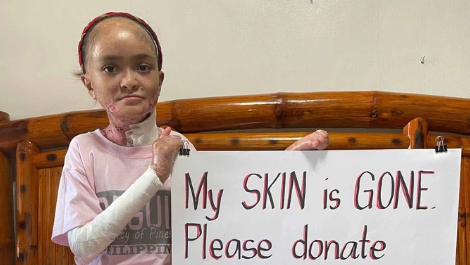 Fundraiser by Je Sica : Please Donate To Stop Maria Joyce Pain And Save ...