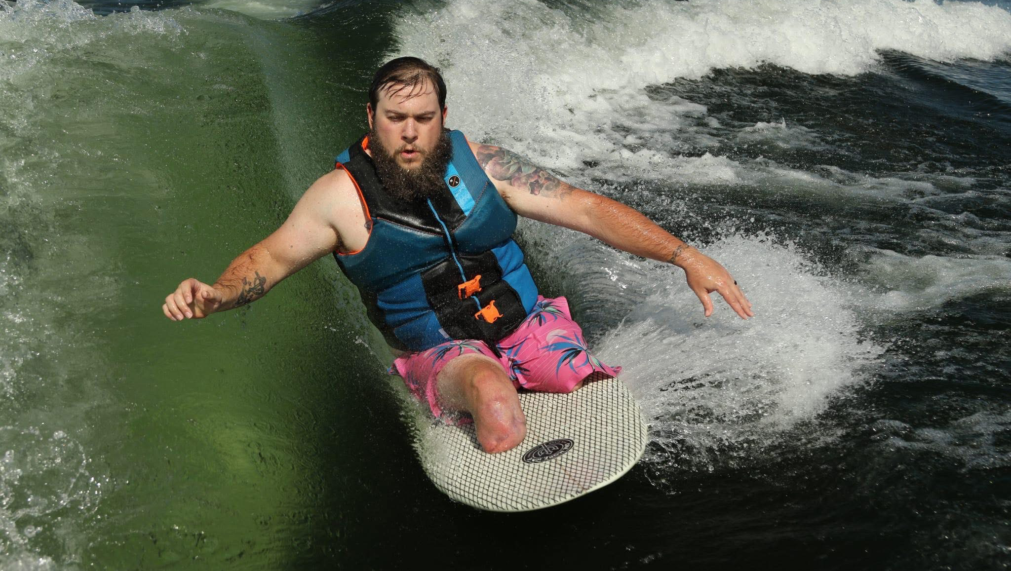 Fundraiser for Misty Hill by Dustin Barnett : Help Double Amputee ...