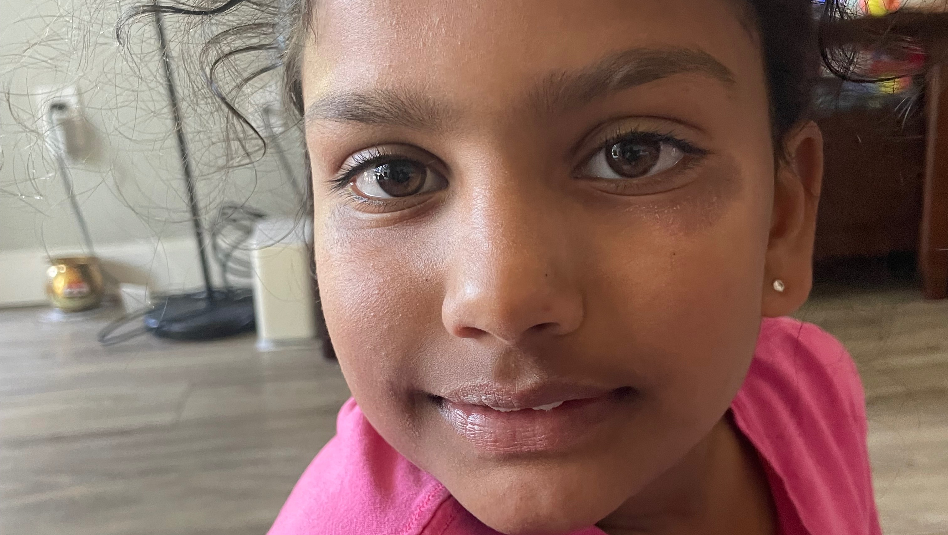 Fundraiser by Govardhan Reddy CMV : Help Nithya Get Critical Medical ...