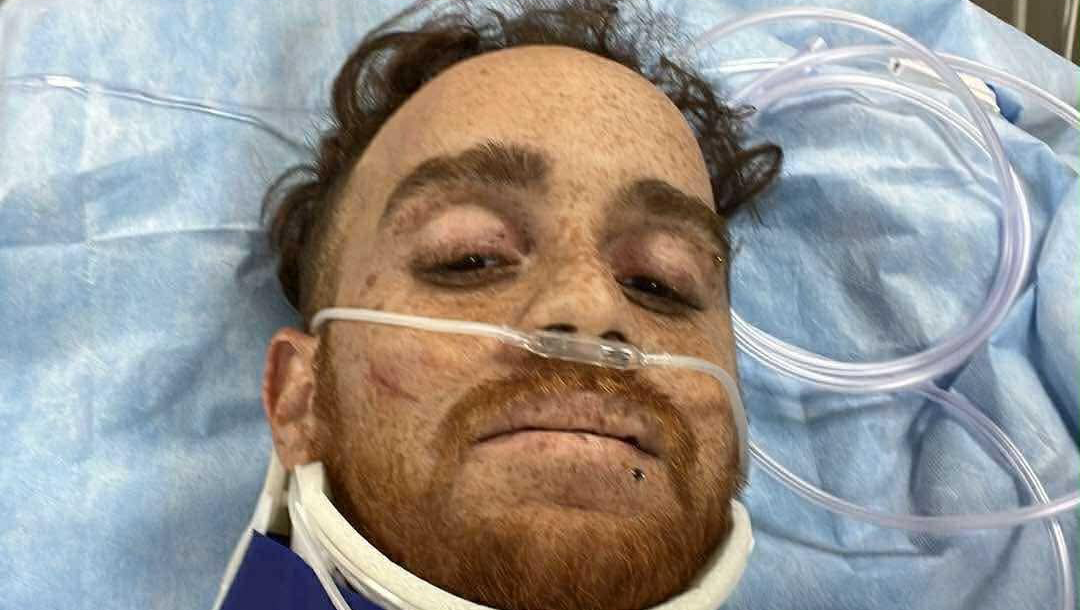 Fundraiser by Megan Embretson : Support Luis' Recovery After Motorcycle Accident