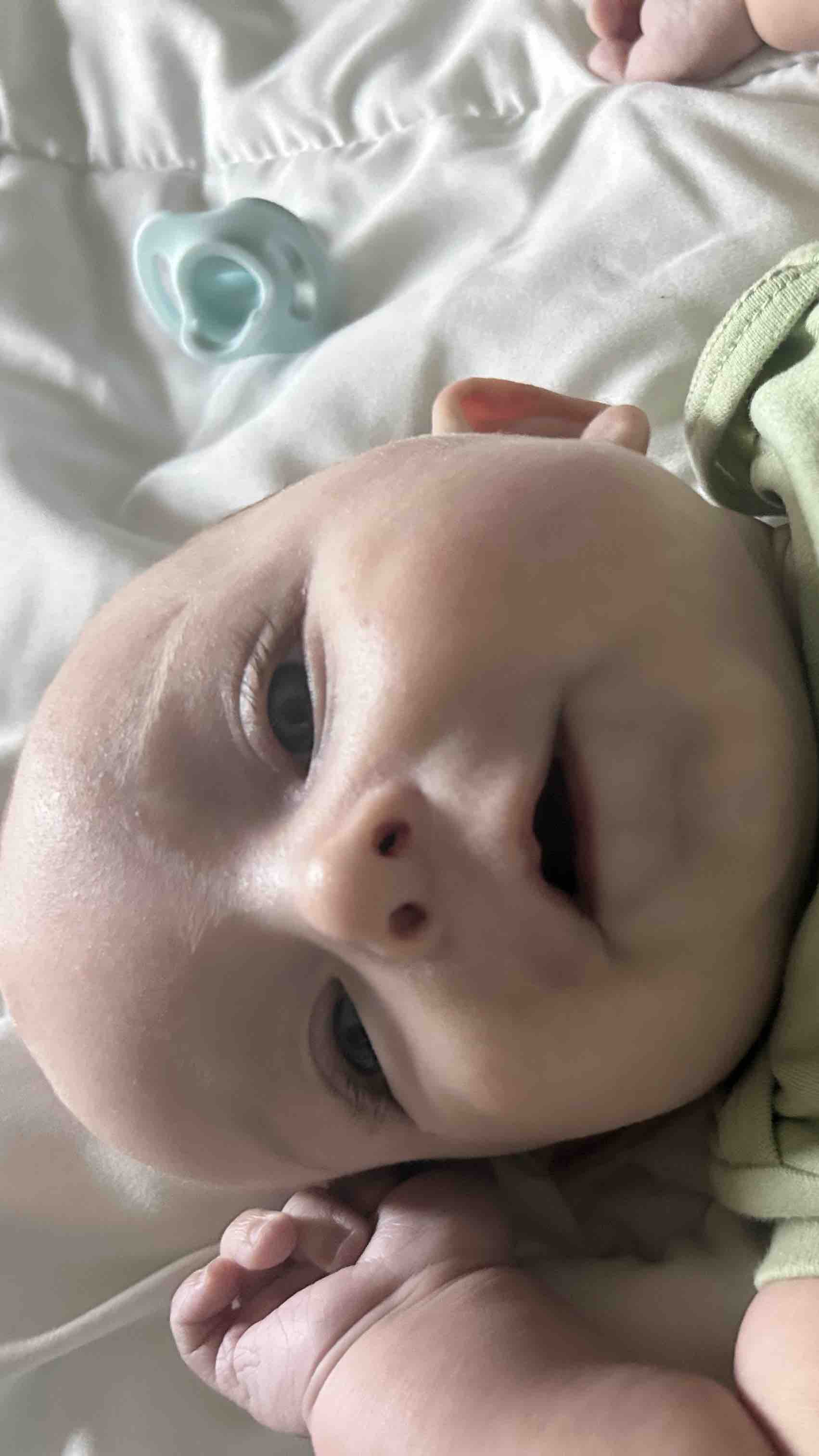Fundraiser by Shayna Draper : Support Baby Noah's Plagiocephaly Treatment