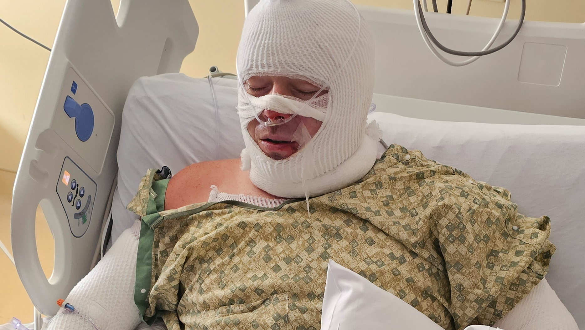 Fundraiser by Emily Burns : Support Jeremy's Burn Recovery Journey