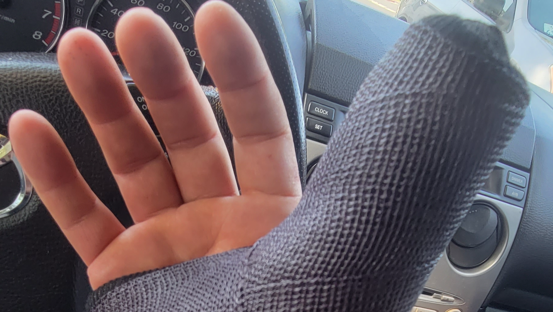 Fundraiser by Jeremy Stephens : One Hand Down — Just Need a Lift