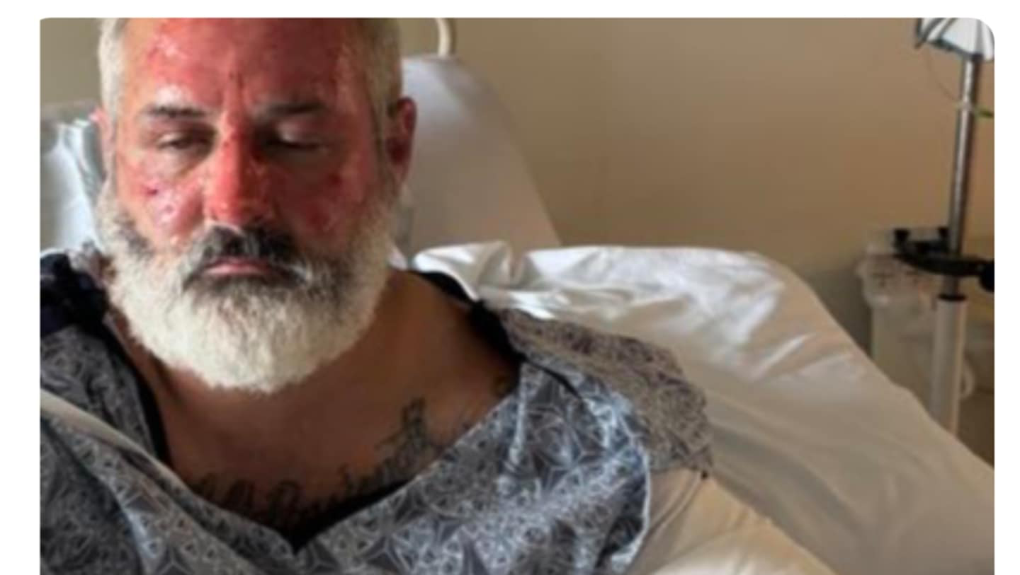 Fundraiser by Barbara Hernandez : Support Terry Sutphin's Burn Recovery ...