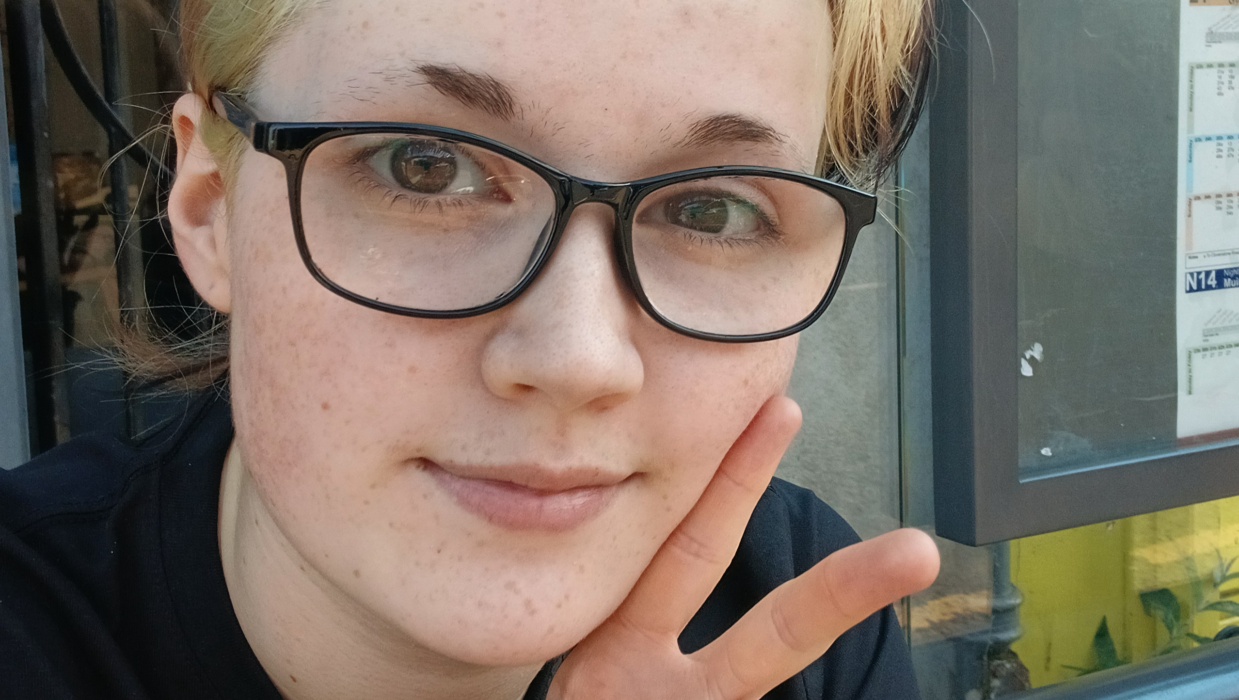 Fundraiser by Kit Scott : Help Kit Get His Wisdom Teeth Removed!