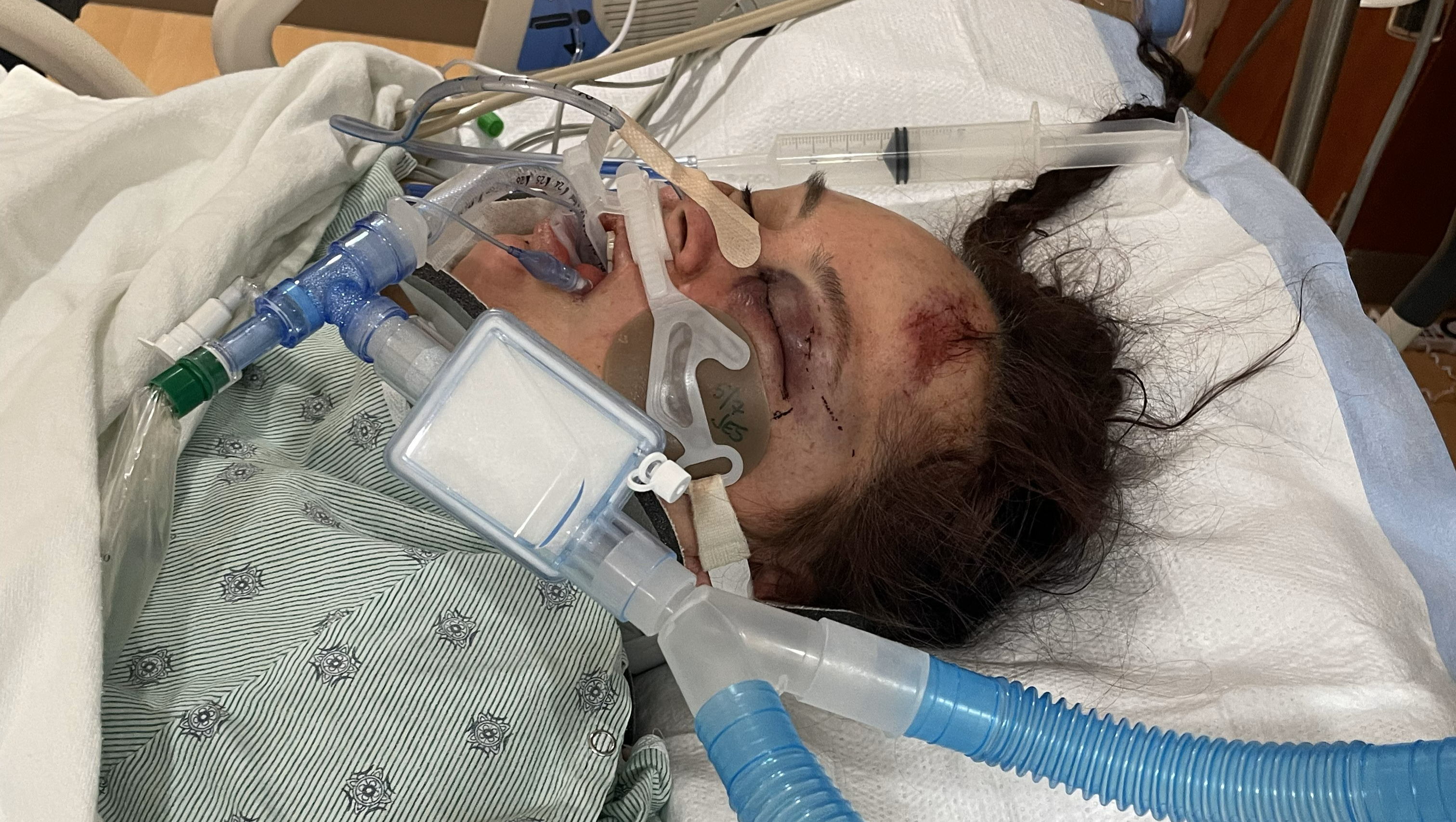 Fundraiser for Raven Lawrence by Amanda Peterson : Support Raven ...