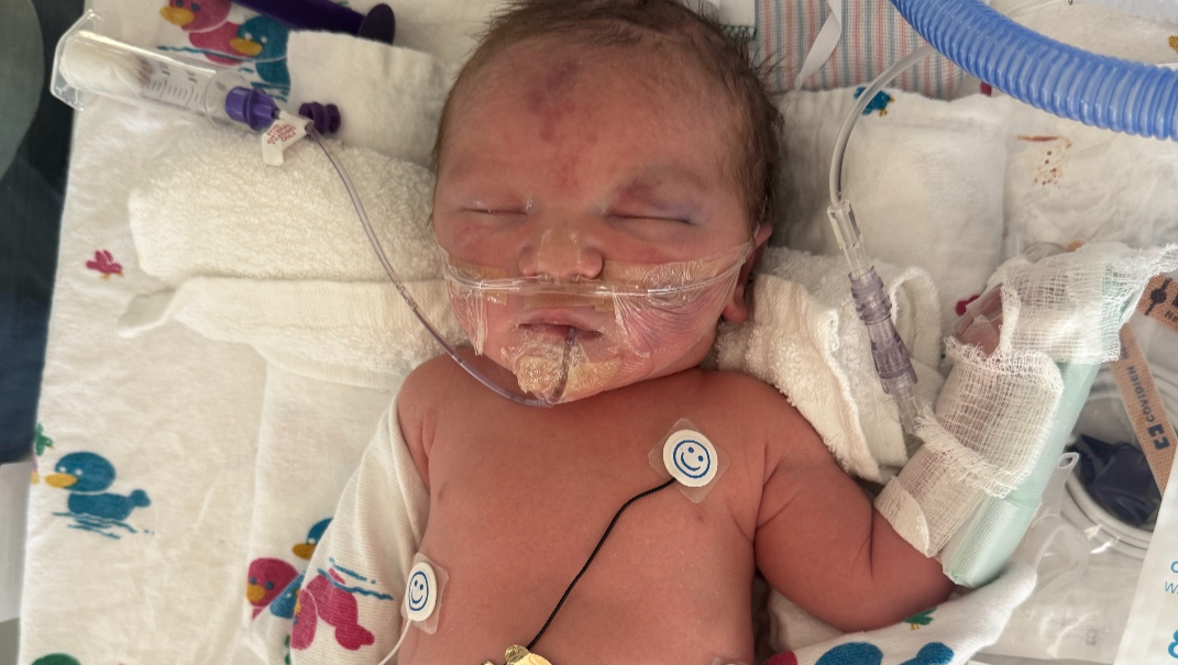 Fundraiser by Leslie Wylupek : Support Baby Carson's Healing Journey