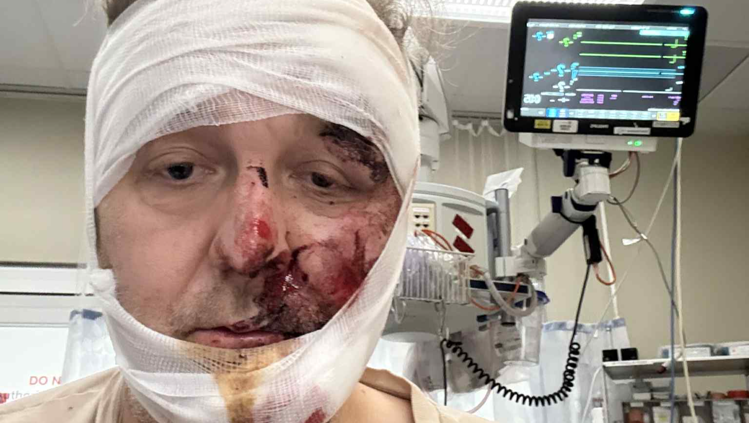 Fundraiser for Shawn Fortney by Ethan Harrison : Support Shawn's ...