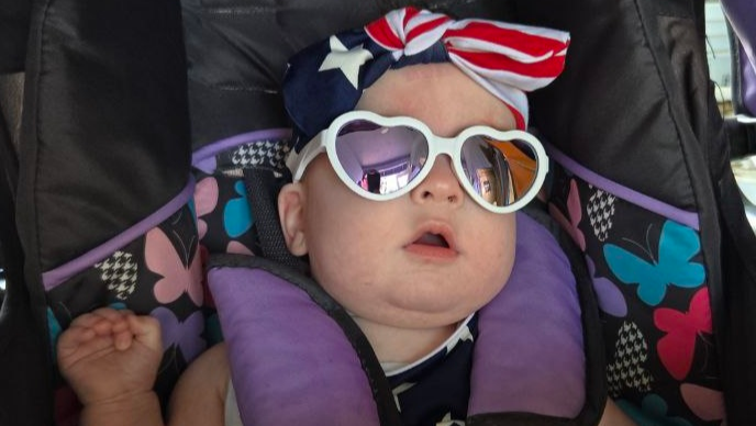 Fundraiser by Rachel Greiner : Help Willow get her cranial remolding helmet
