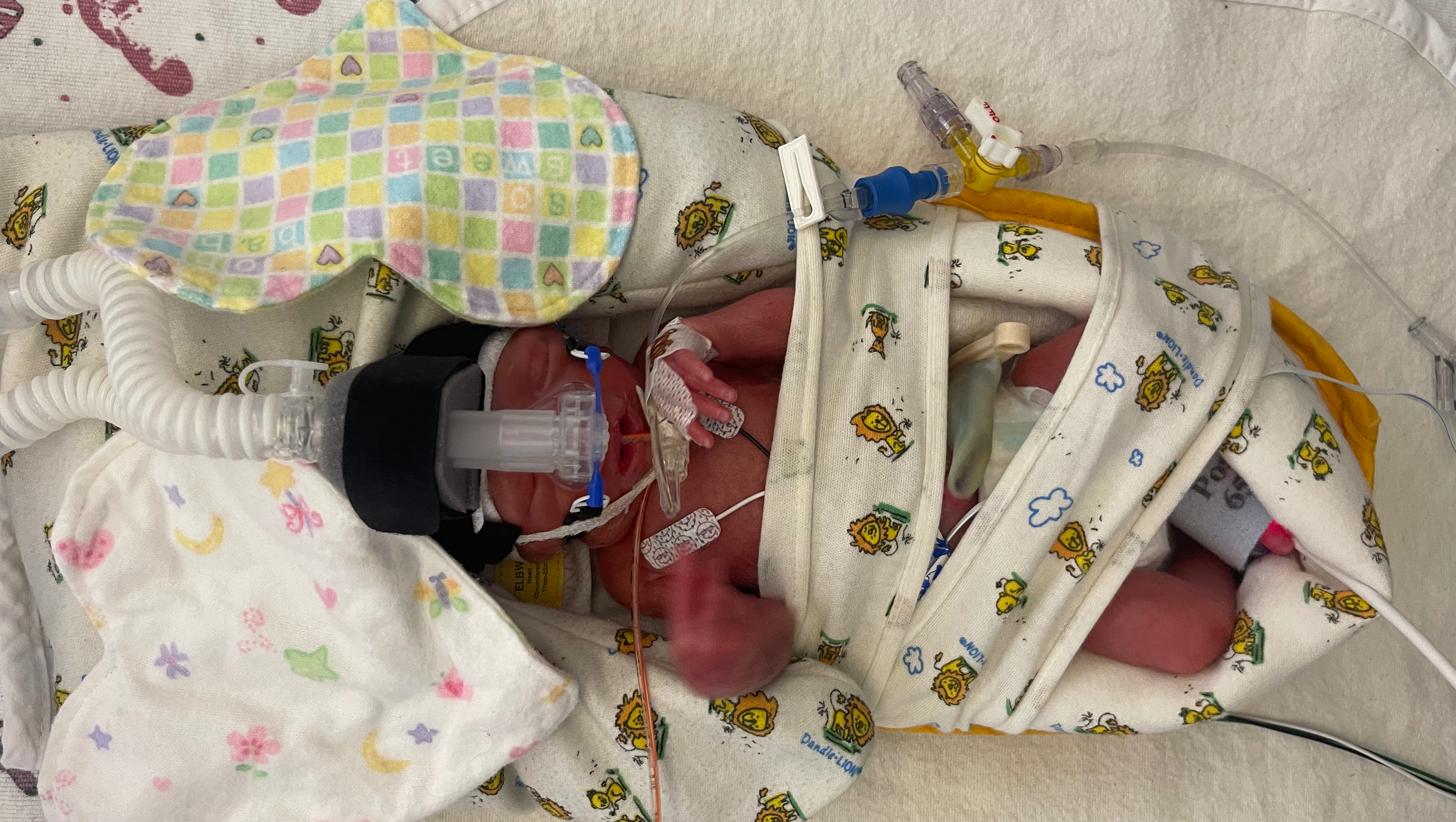 Fundraiser by Ashleigh Linnemann : Support for Zach, Madison, & baby Lilith
