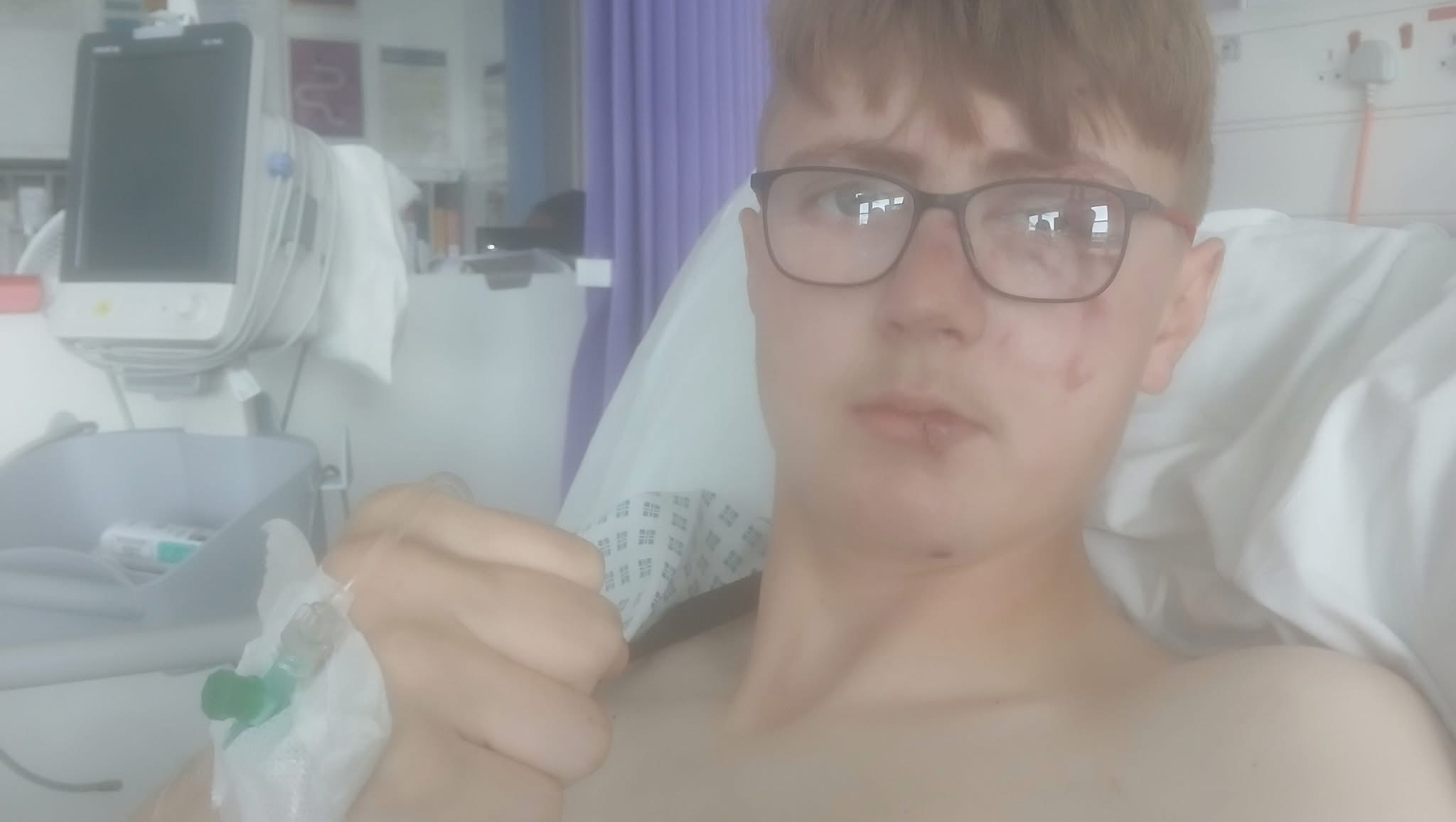 Fundraiser by Jay Latham : Help miles through his accident
