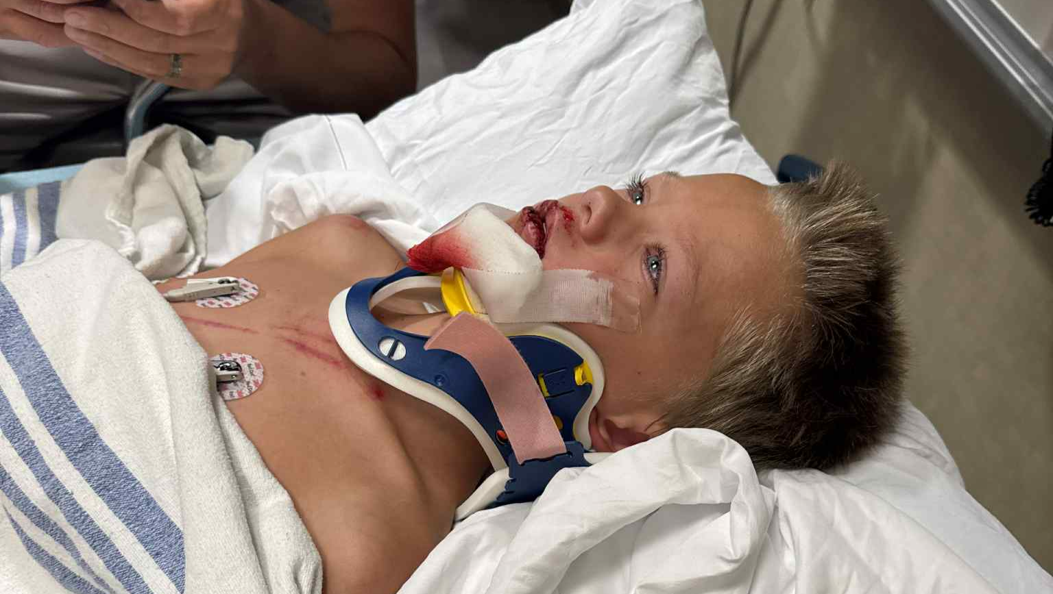 Fundraiser for Kaitlyn Doyle by Tristan Zurbrugg : Help Jace Heal – A ...