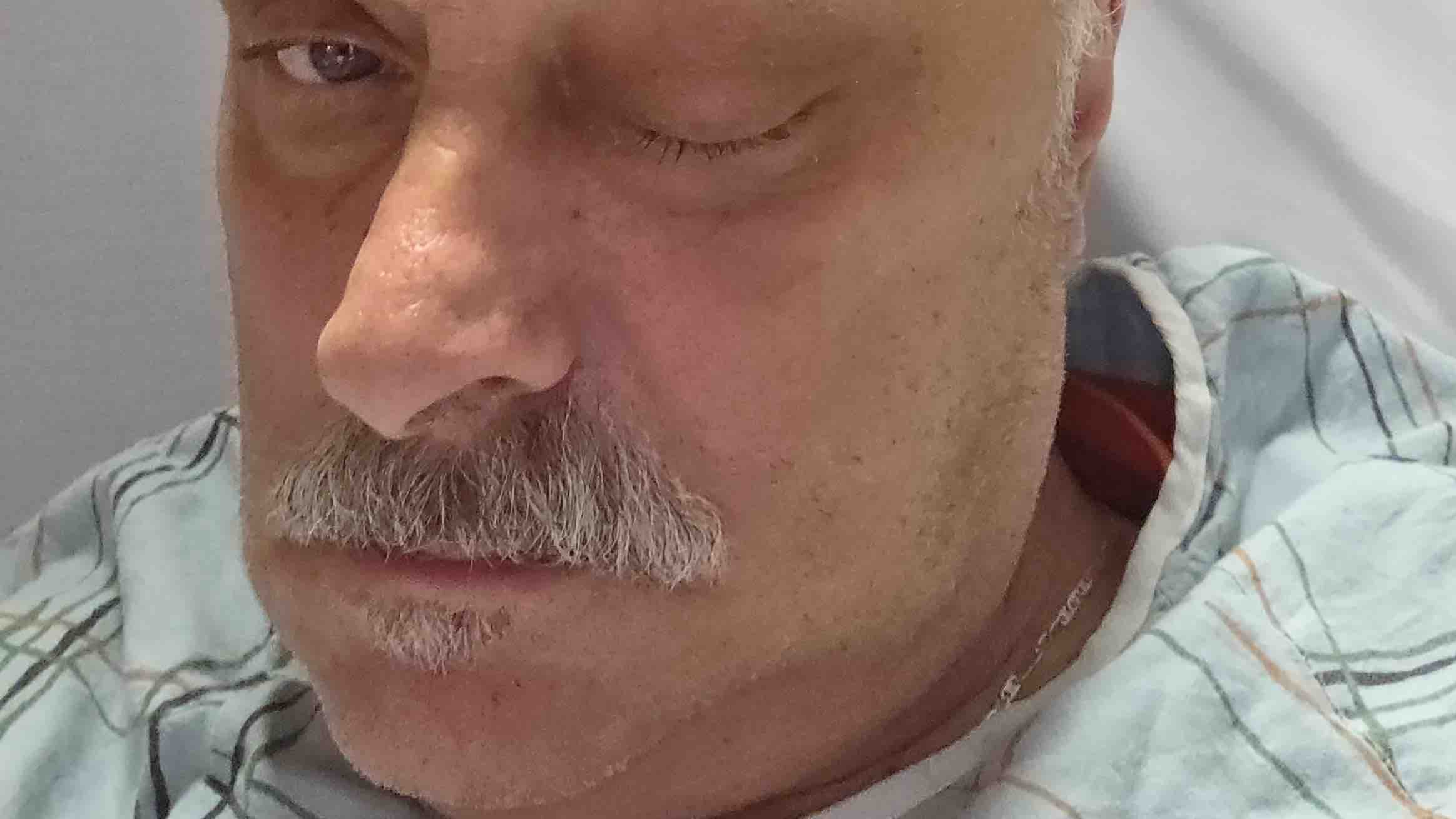 Fundraiser by LINDA SILVER : Help Fred Marcheschi Get the Treatment He ...