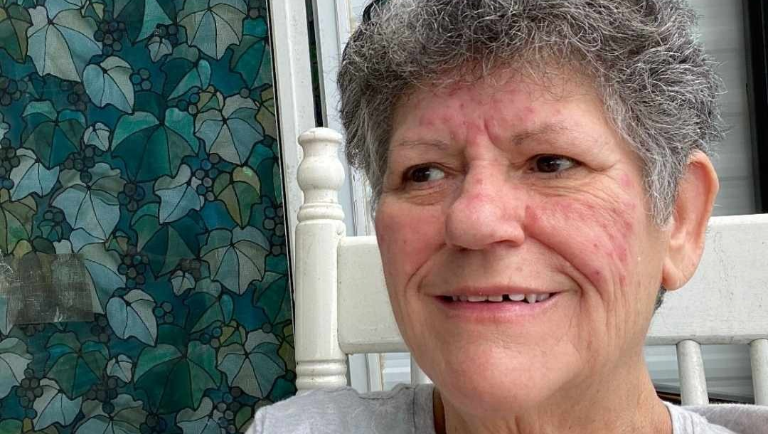 Fundraiser for Stacey Eschete by Gabrielle Breaux : Restore Judy's Life ...