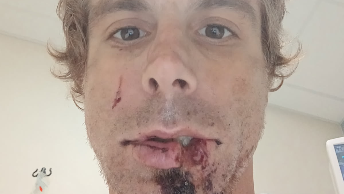 Fundraiser for Samuel Carfagno by Nathan Lipson : Help Sam Heal and Recover from Assault