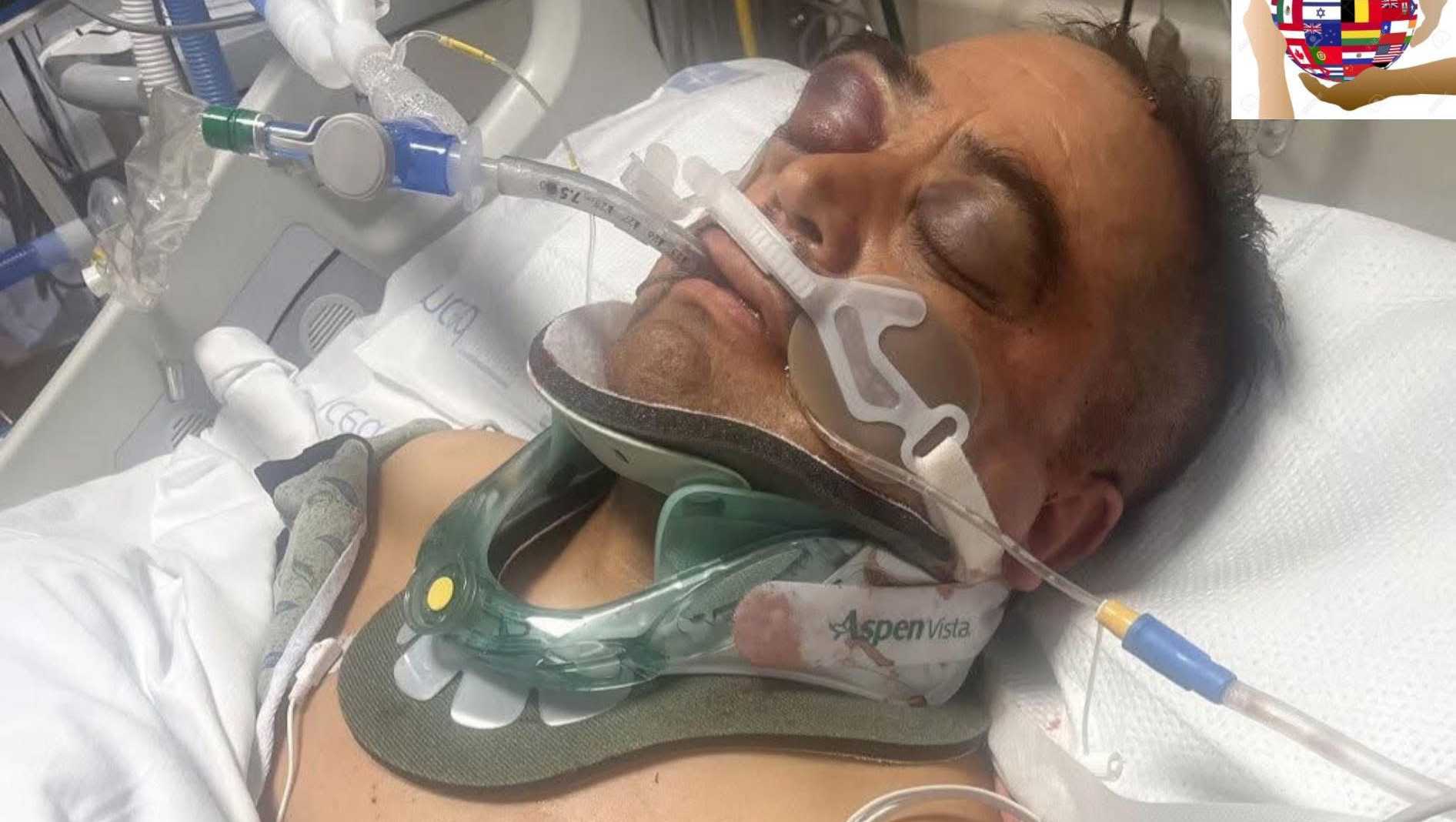 Fundraiser by Jesus Alexander Galdamez Mejia : Ayuda para nuestro amigo ...