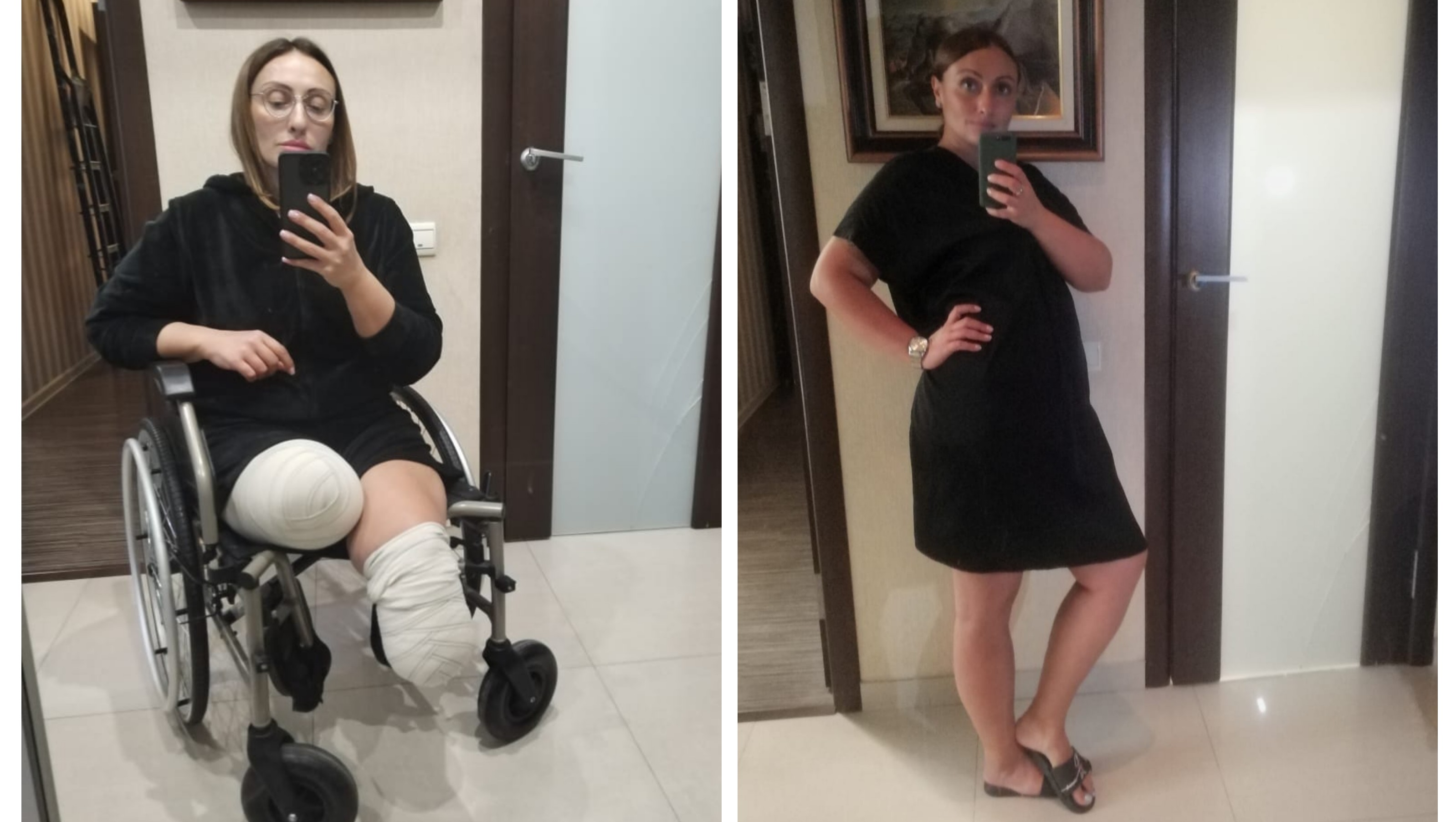 Fundraiser by Irina Gurevich : Help Ella Walk Again