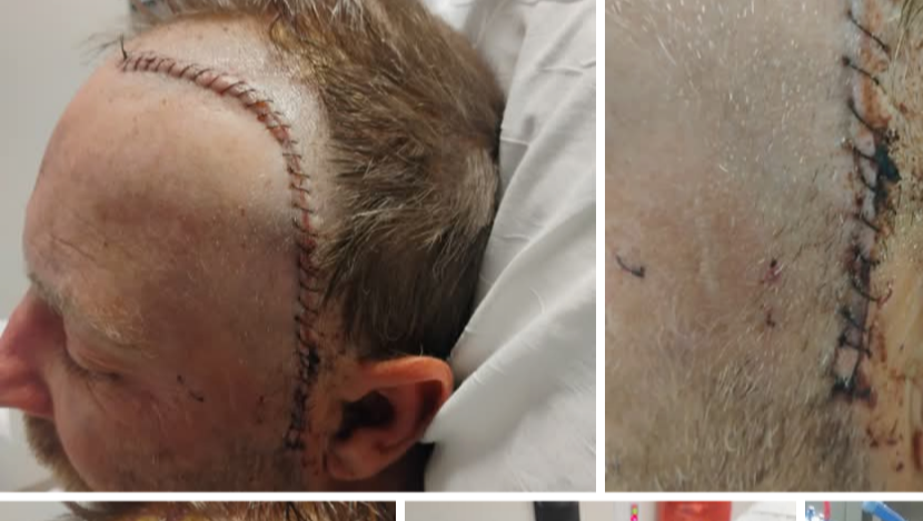 Fundraiser for Ken Magee by Dan Solari : Help Ken Magee with Medical ...