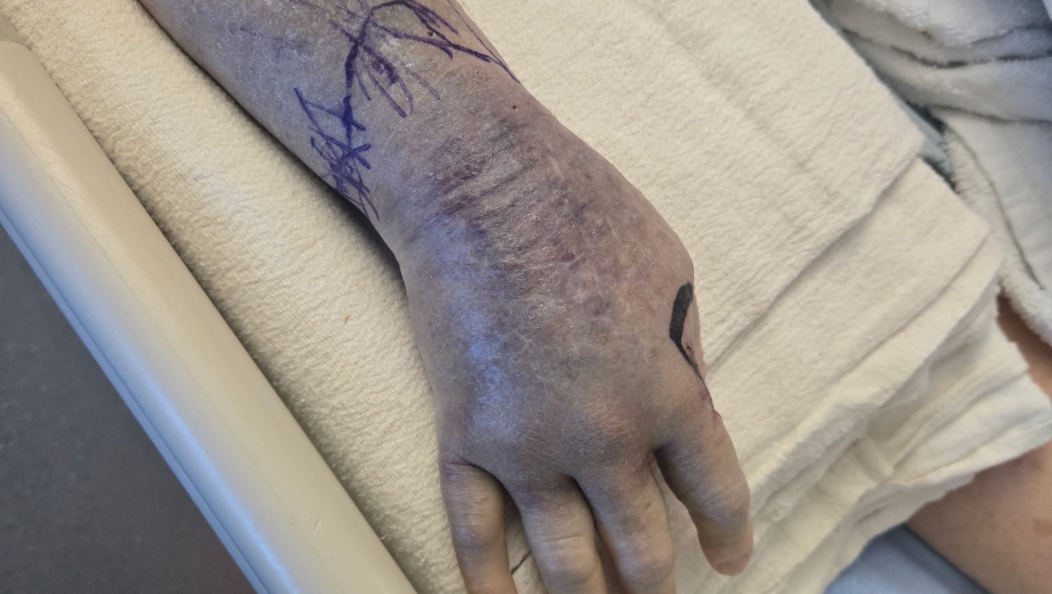 Fundraiser for Austin Barba by Karole Bryant : Support Marlena Barba’s ...