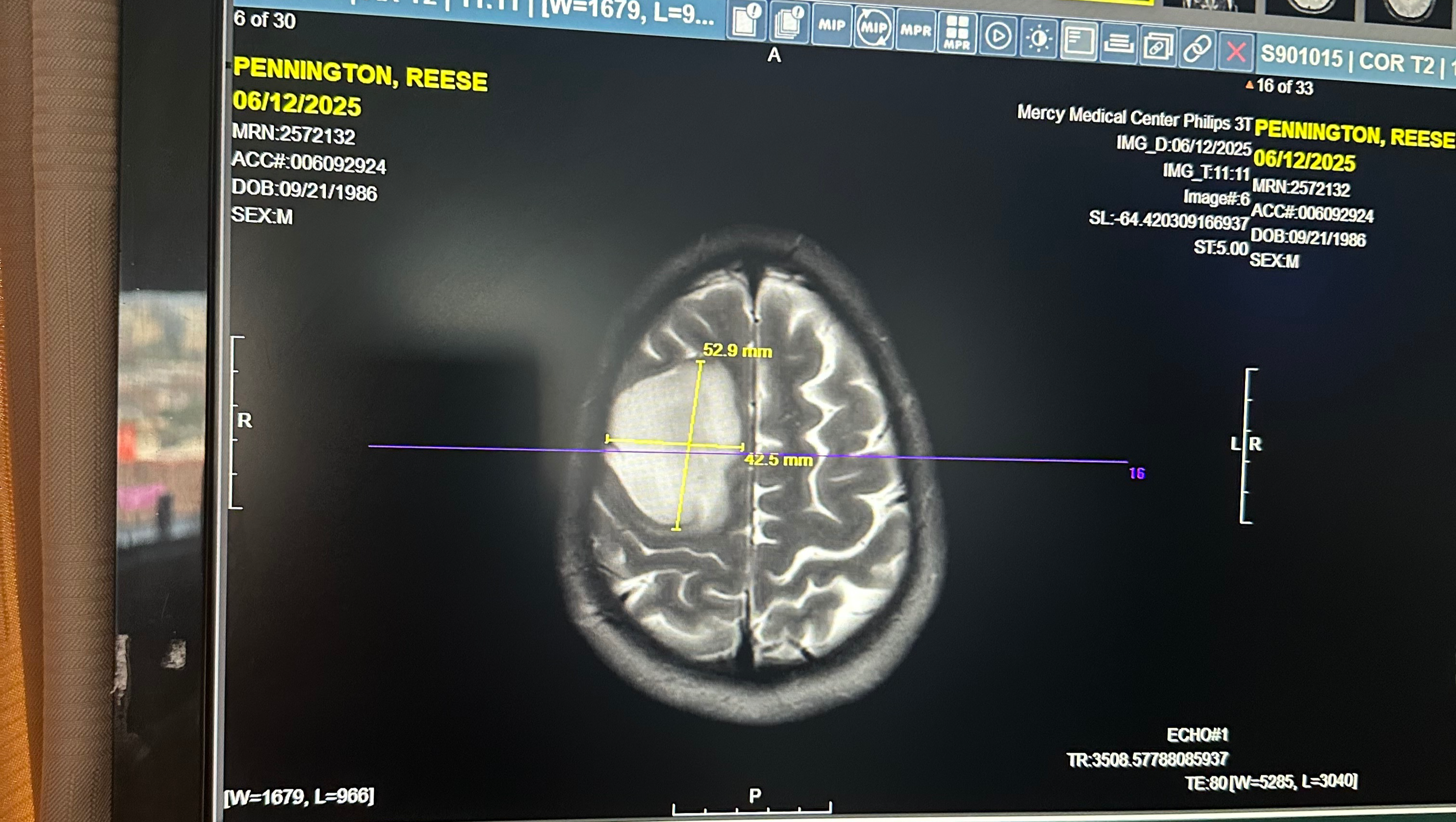 Fundraiser for Reese Pennington by Caitlyn Schiner : Help Reese Heal ...