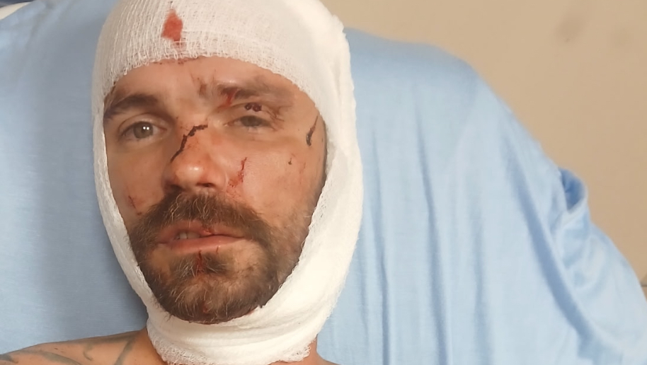 Fundraiser for Larry Cates by Regina Lafever : Help Dustin Recover from ...