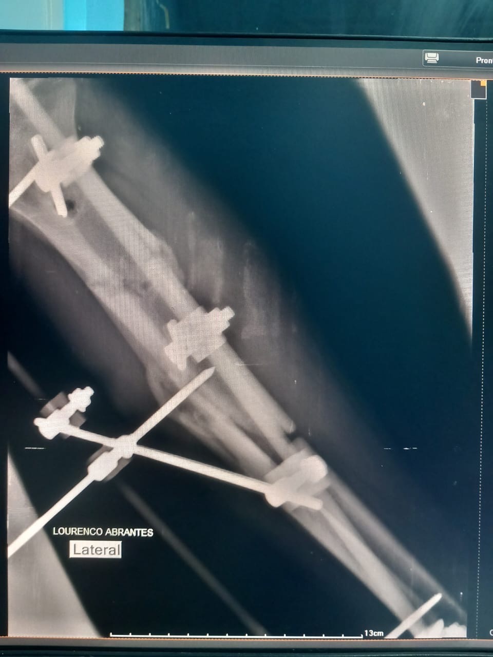 Fundraiser by MDO Official : Uma vida marcada por duas tragédias