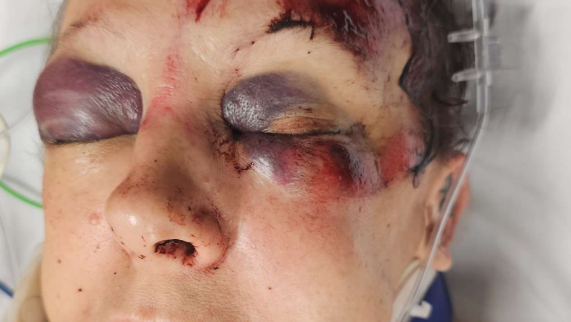 Fundraiser for Stacey Conley by Grace Conley : Aid Stacey's Journey to ...