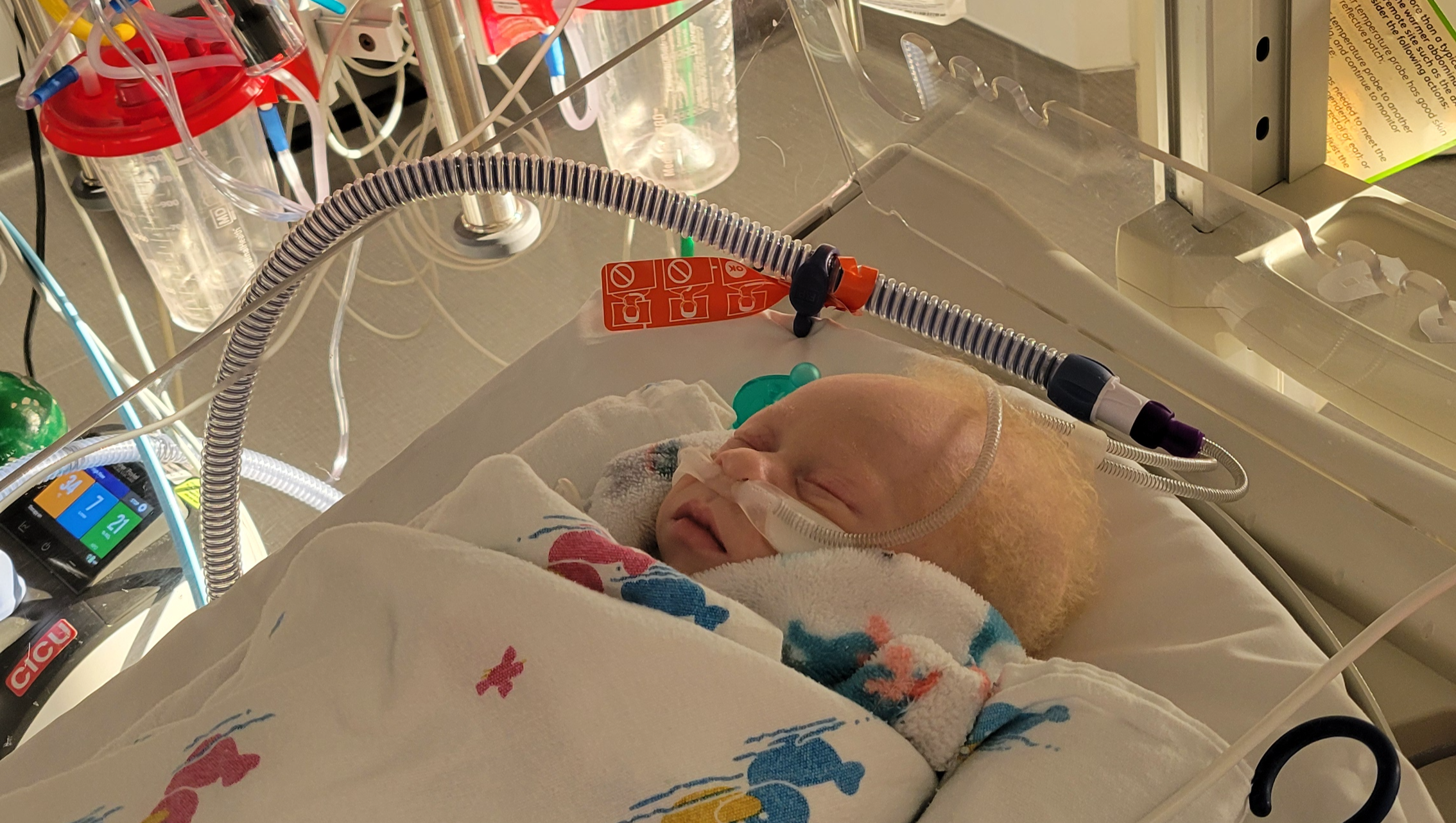 Fundraiser by Iisha Howell : Support Ryder's Open Heart Surgery