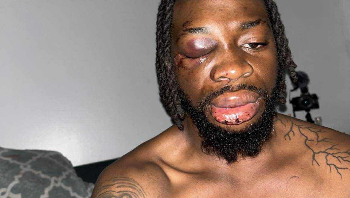 Fundraiser by Jason Callwood : Help Jason Heal After Hit-and-Run Tragedy