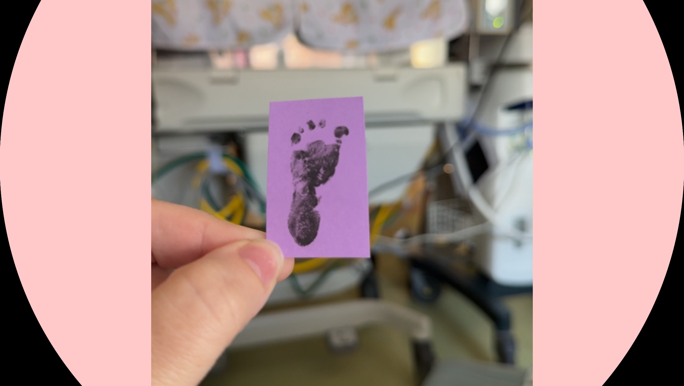 Fundraiser for Hannah Kallin by Keith Kallin : Tiny Fighter: Wrenley ...