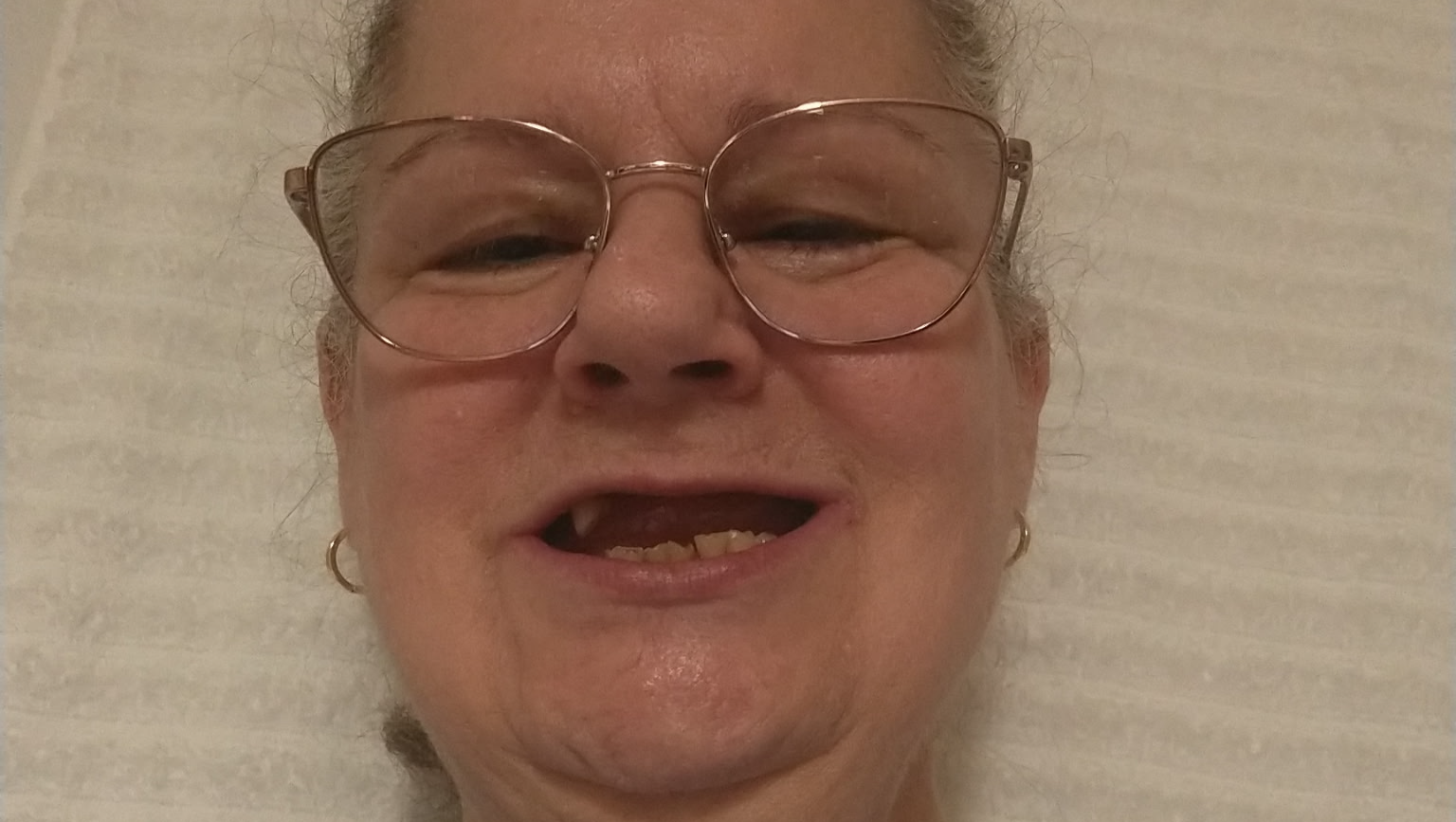 Fundraiser by Lee Grantham : Join Patrice in Her Smile Restoration Journey