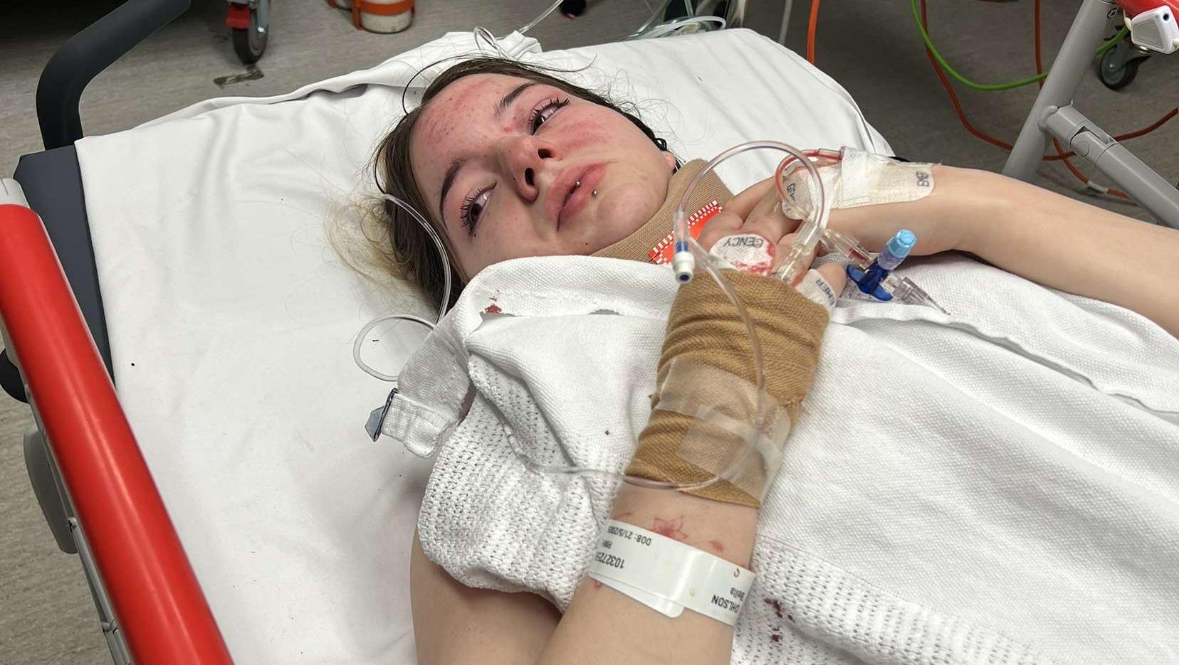 Fundraiser by Emily Ohlson : Help Bella recover from a traumatic injury