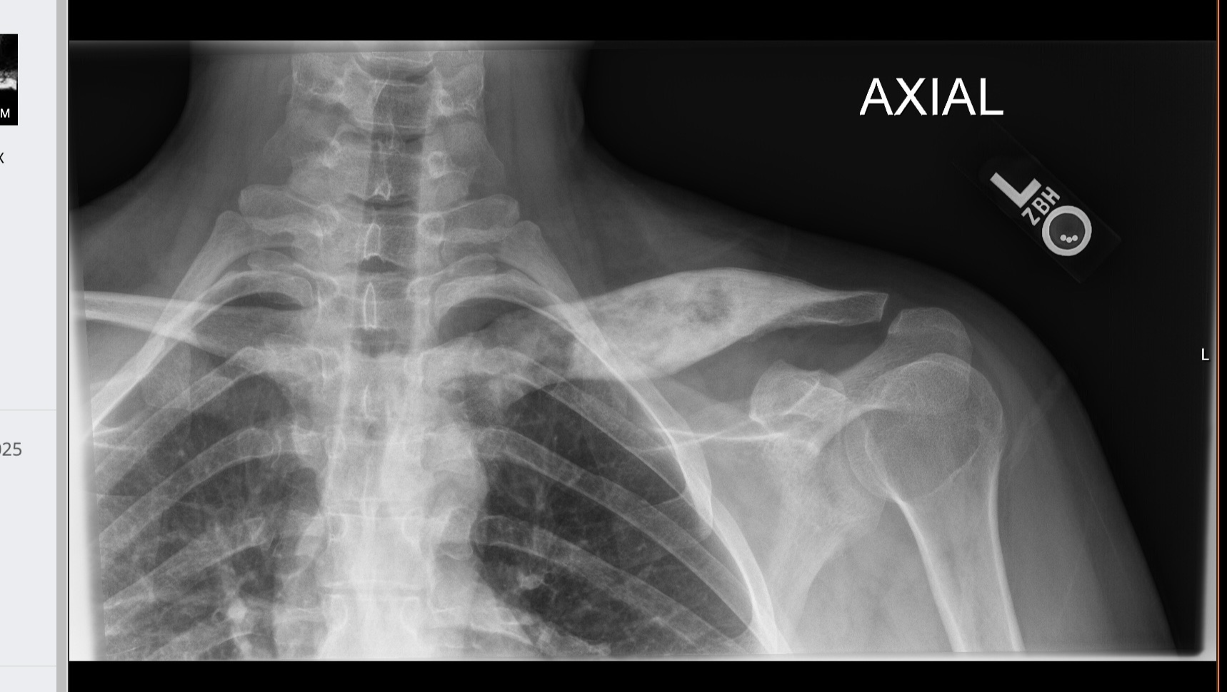 Fundraiser by Desiree Rowles : Support Jessica's Emergency Surgery and ...