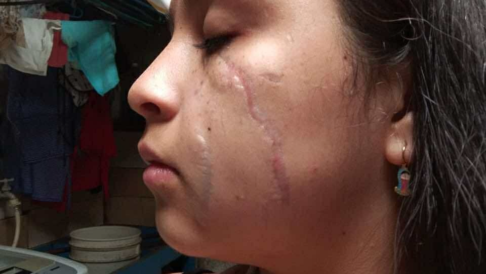 Fundraiser by Magdalena Rooney-Velez : Restore Sarita's Smile After Tragedy